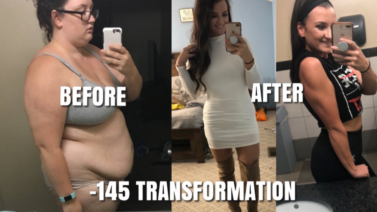 145 Pound Weight Loss Transformation Before And After Photos Videos 145-pound-weight-loss-transformation-before-and-after-photos-videos