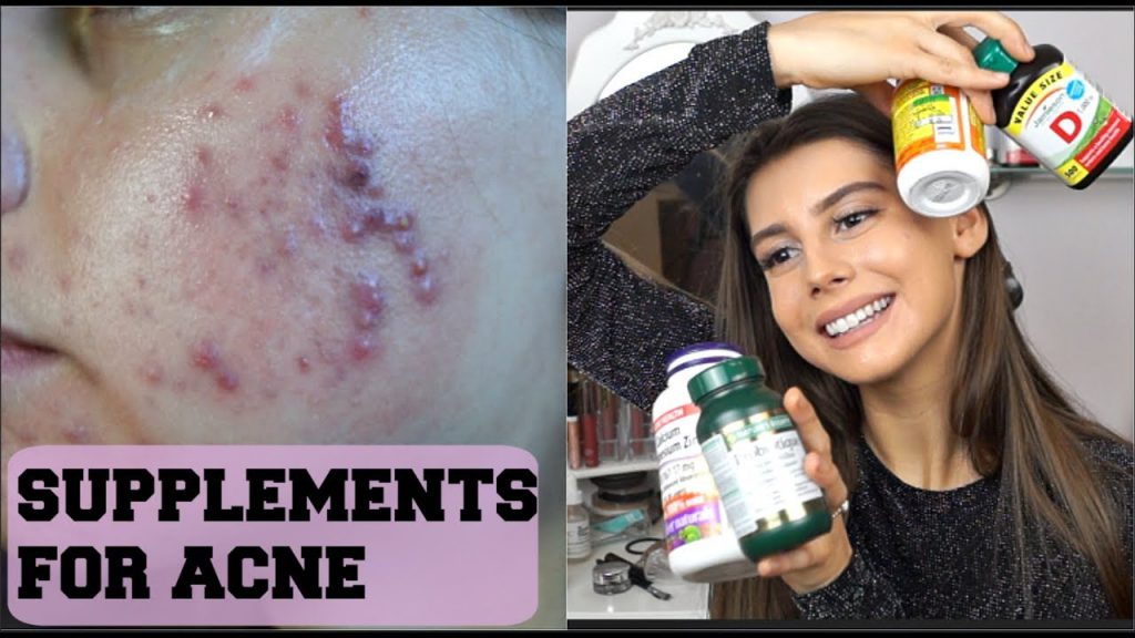 SUPPLEMENTS I TAKE FOR FLAWLESS SKIN AND ACNE|| Vitamin D, Zinc ...