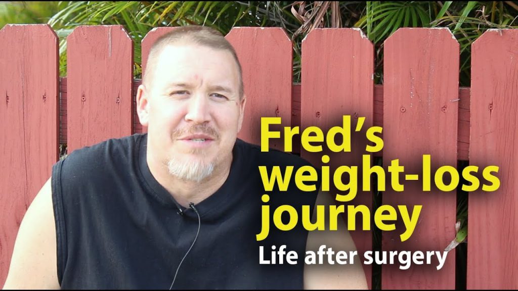 Fred's weight-loss journey: Life after surgery – Man-Health-Magazine ...