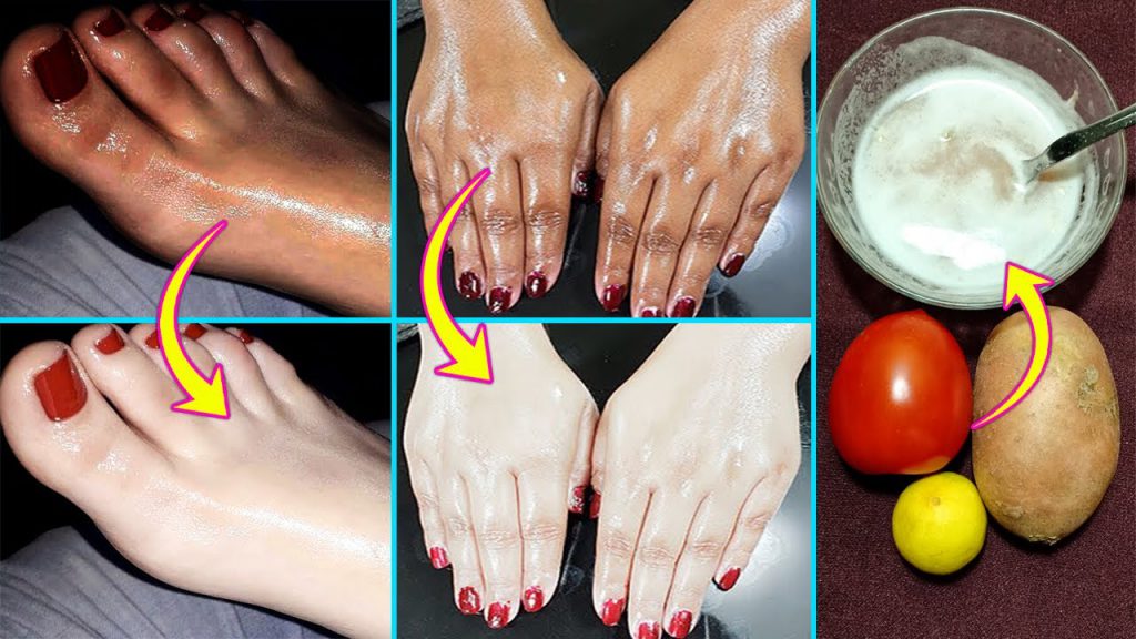 Quick Hand And Feet Whitening Pack – Best Natural Home Remedy For ...