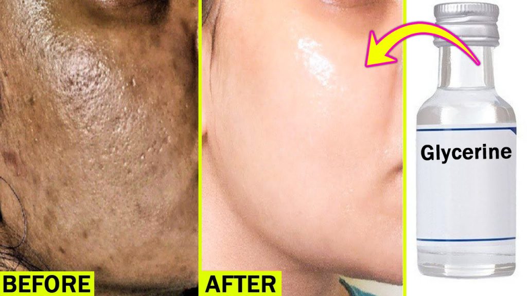 Use Glycerin This Way Your Skin Will Look So Young, Tight, Spotless ...