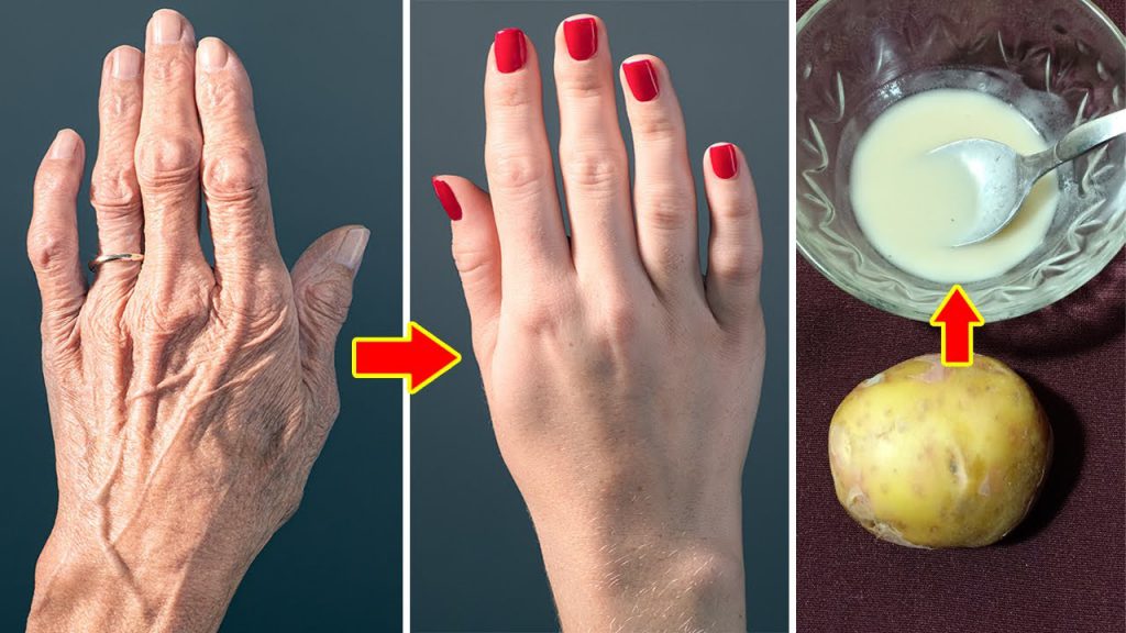 Make Your Hands Look 10 Years Younger, Remove Hand Wrinkles, Get Soft ...